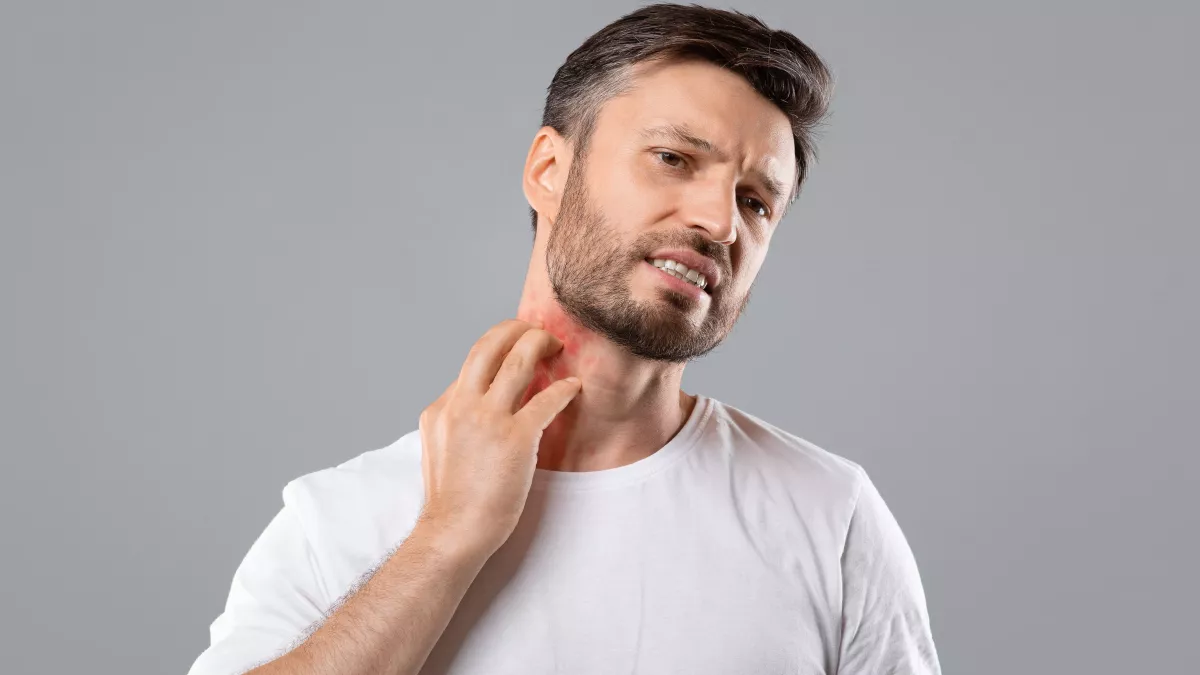 Urticaire, œdème de Quincke - Grands Mères